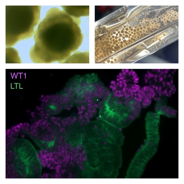 3D Organoid Models for Tumor Research with CERO 3D
