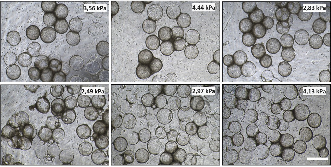 Alginate Microcarriers for Stem Cells